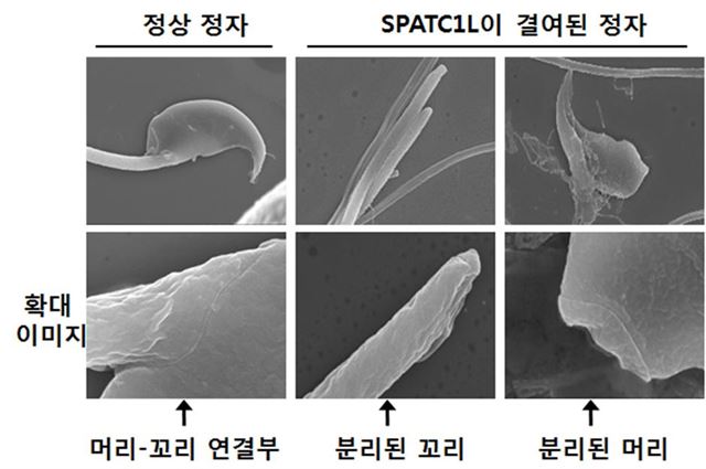 남성 불임 치료 돌파구 찾았다